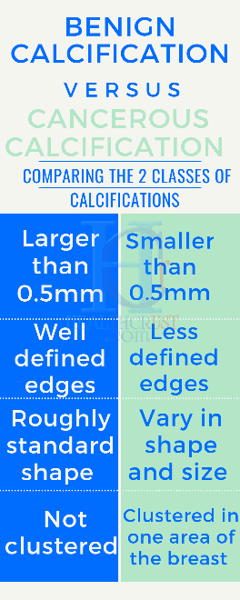 What to know about calcium deposits in the breast.